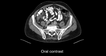 Abdominal CT: Phases • LITFL • Radiology library