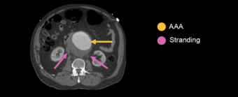 Abdominal CT: Phases • LITFL • Radiology library