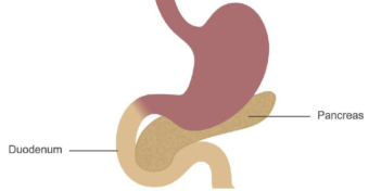 Abdominal CT: small intestine • LITFL • Radiology Library