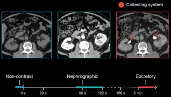 Abdominal CT: Urogram • LITFL • Radiology library
