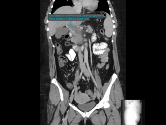 CT Case 058 • LITFL • CT scan interpretation