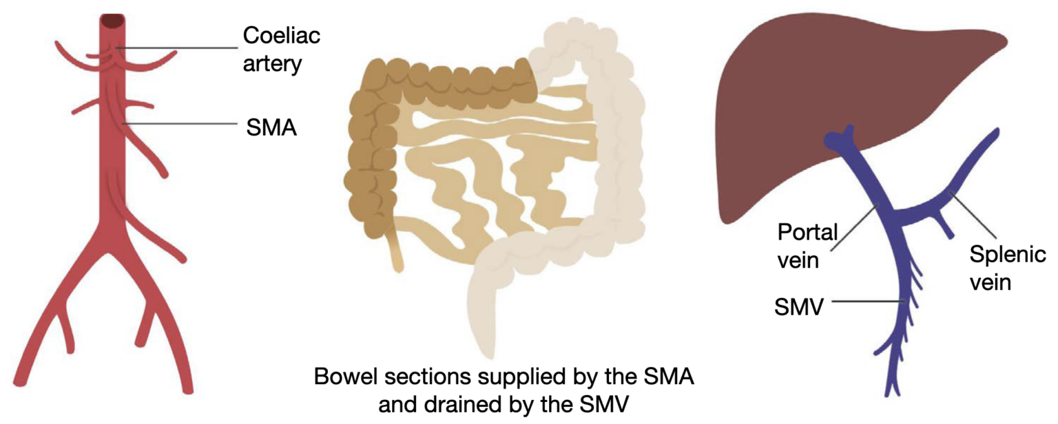 Abdominal Ct Intestinal Ischaemia • Litfl • Radiology Library