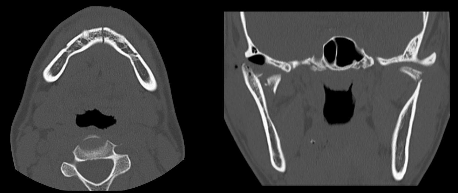 CT Case 021 • LITFL • CT scan interpretation