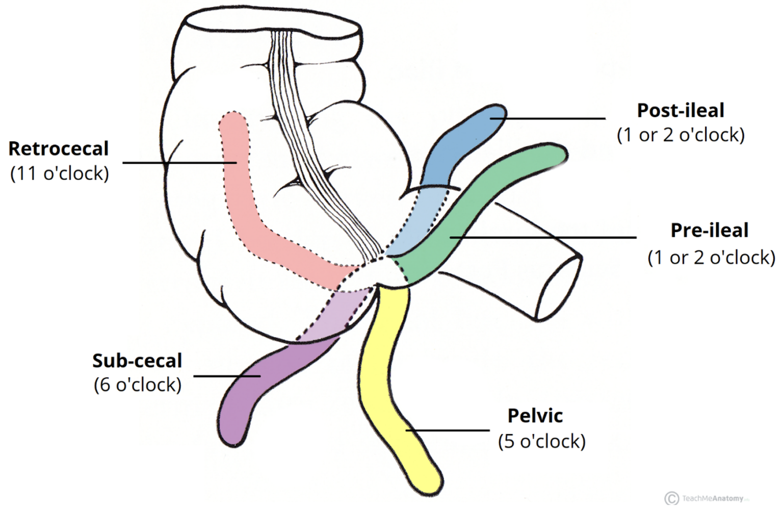 CT Case 025 • LITFL • CT scan interpretation