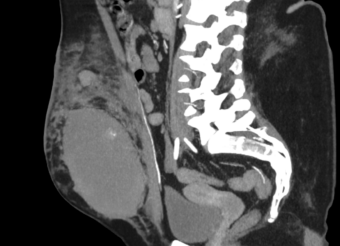 CT Case 031 • LITFL • CT scan interpretation