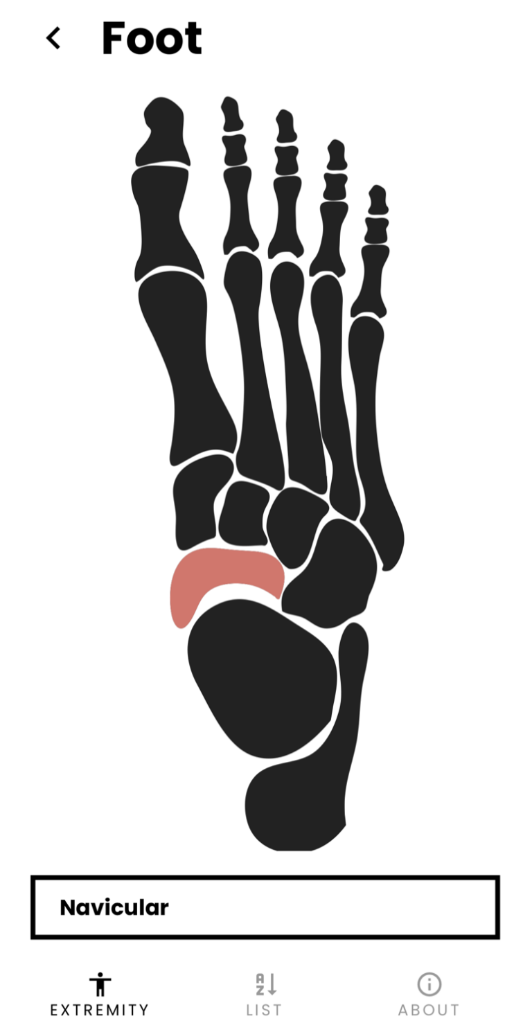 Fractures App • LITFL • App review