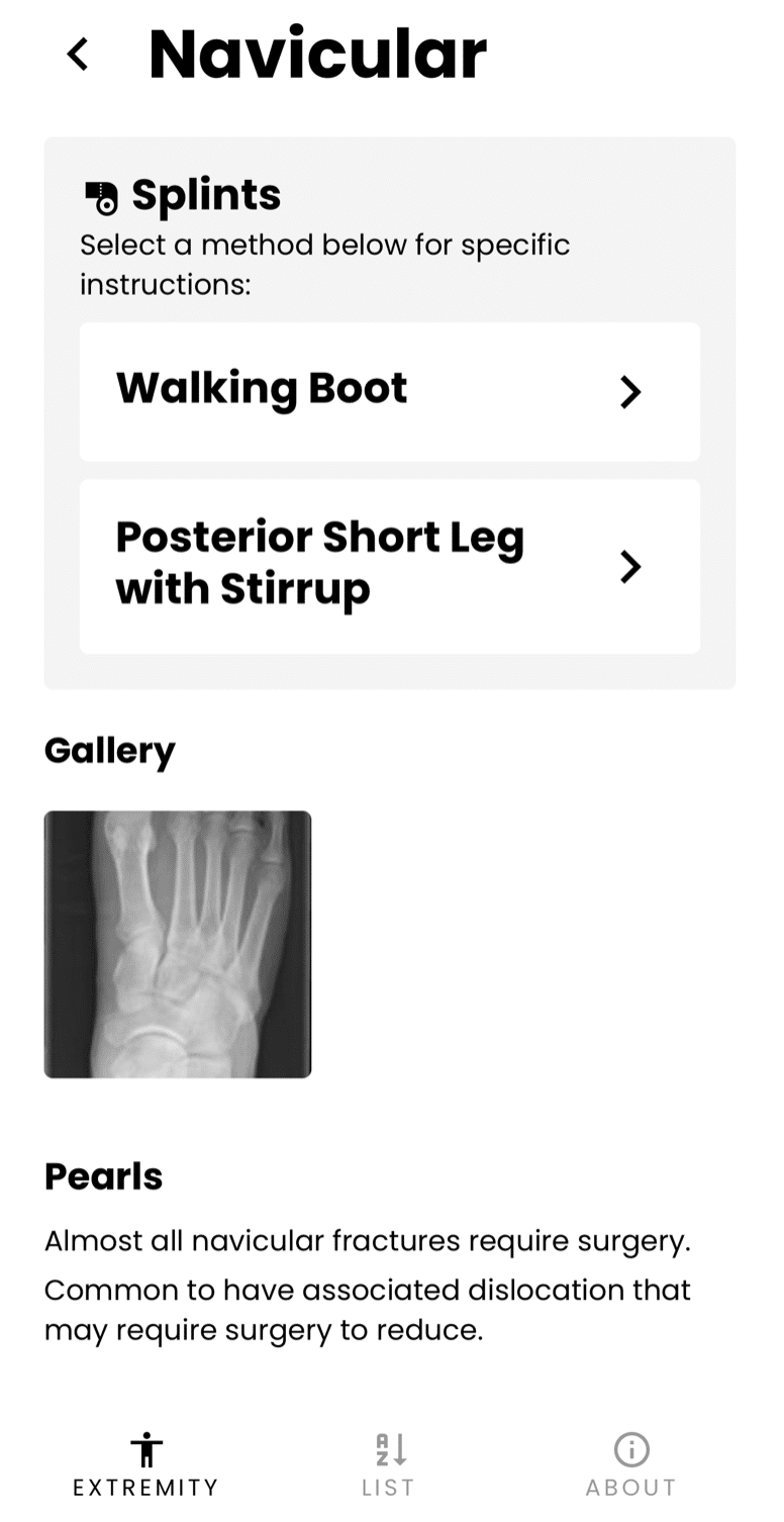 Fractures App • LITFL • App review