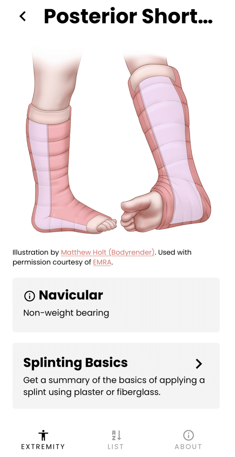 Fractures App • LITFL • App review