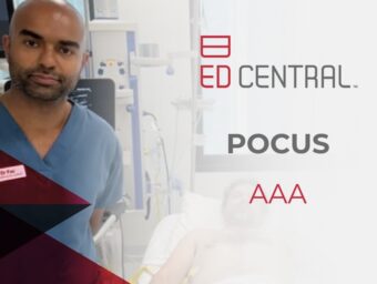 Ultrasound Library Archives • LITFL