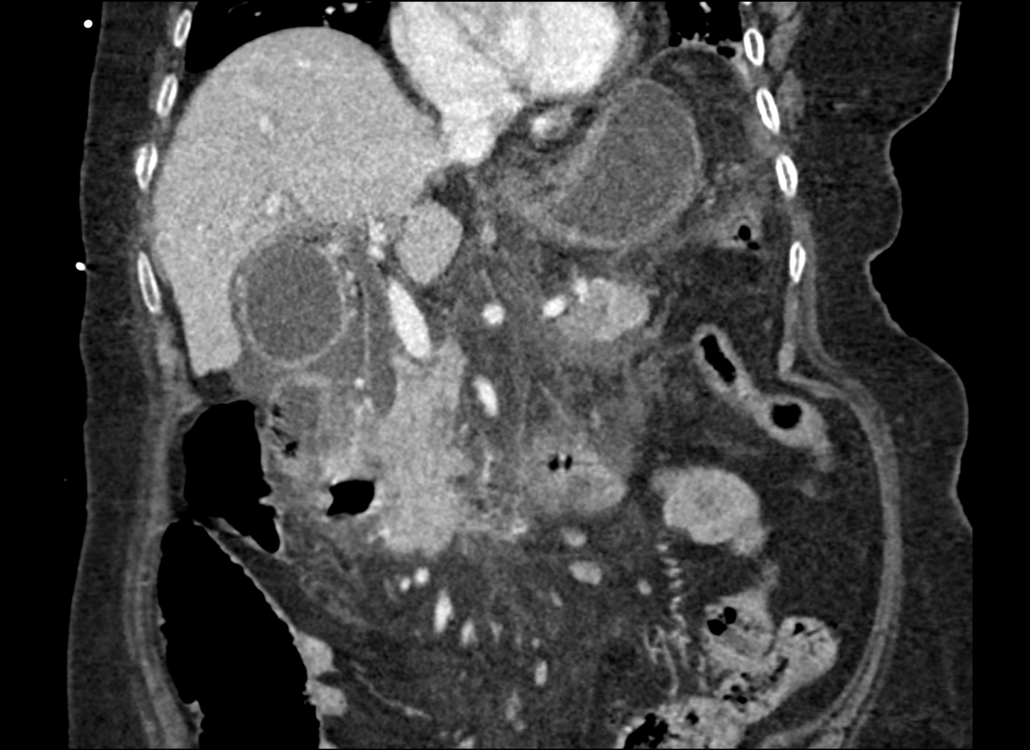 CT Case 036 • LITFL • CT scan interpretation