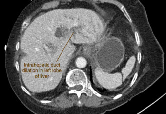CT Case 036 • LITFL • CT scan interpretation