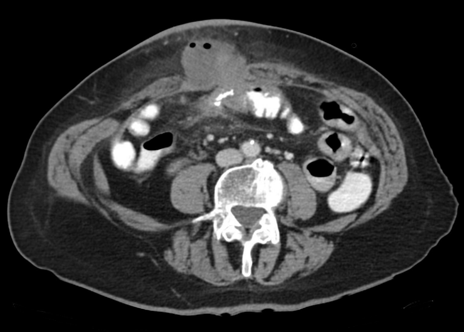 CT Case 039 • LITFL • CT scan interpretation