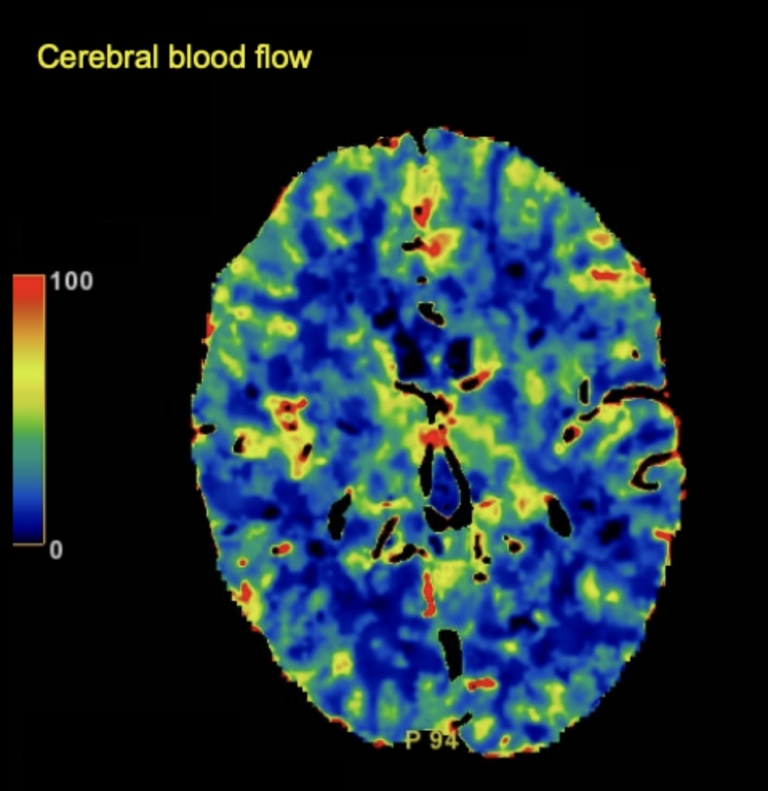 CT Case 040 • LITFL • CT scan interpretation