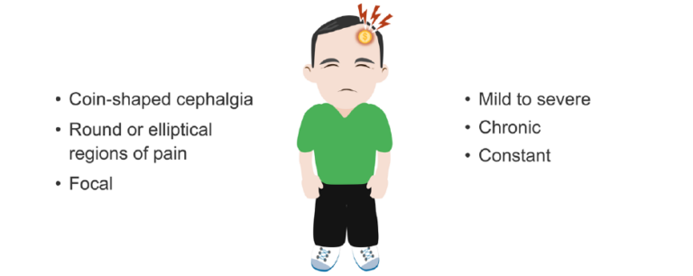 Other primary headaches • LITFL • Neurology library