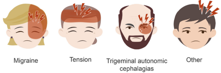 Headache classification • LITFL • Neurology library