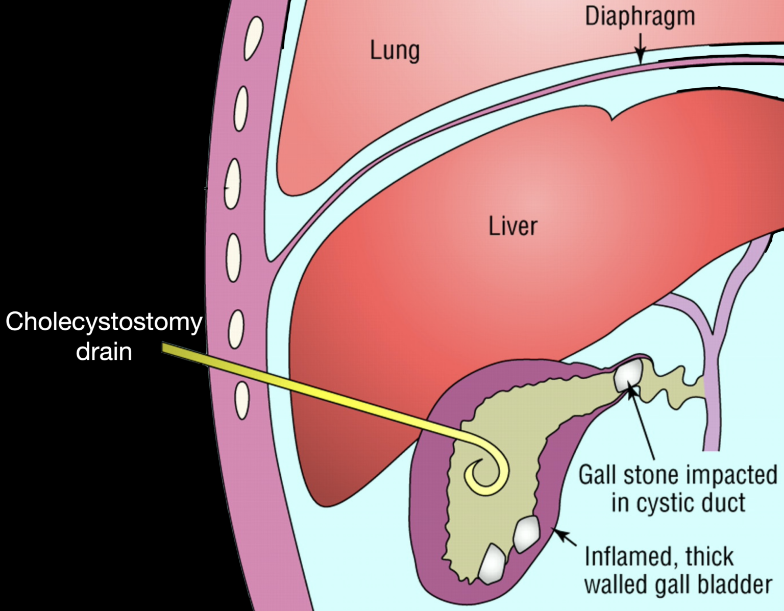 CT Case 036 • LITFL • CT scan interpretation