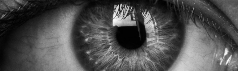 Bashed, Blind and Bulging • LITFL • Ophthalmology Befuddler