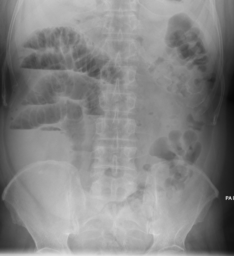 CT Case 048 • LITFL • CT scan interpretation