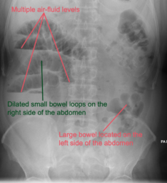 CT Case 048 • LITFL • CT scan interpretation