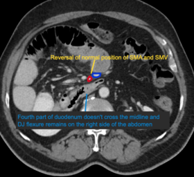 CT Case 048 • LITFL • CT scan interpretation