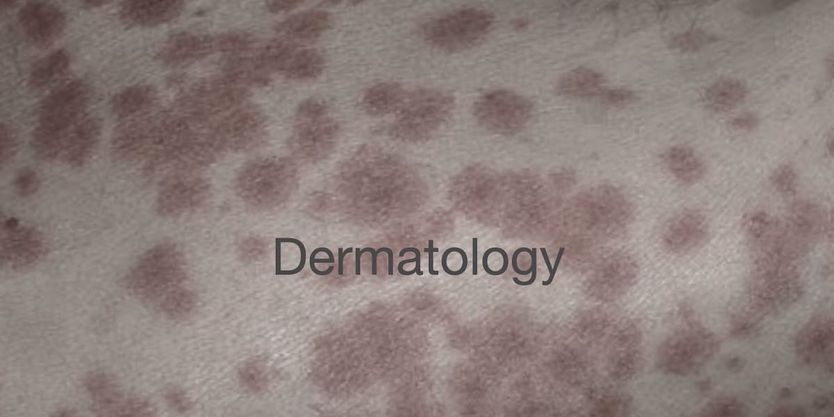 Dermatology • LITFL • Basics