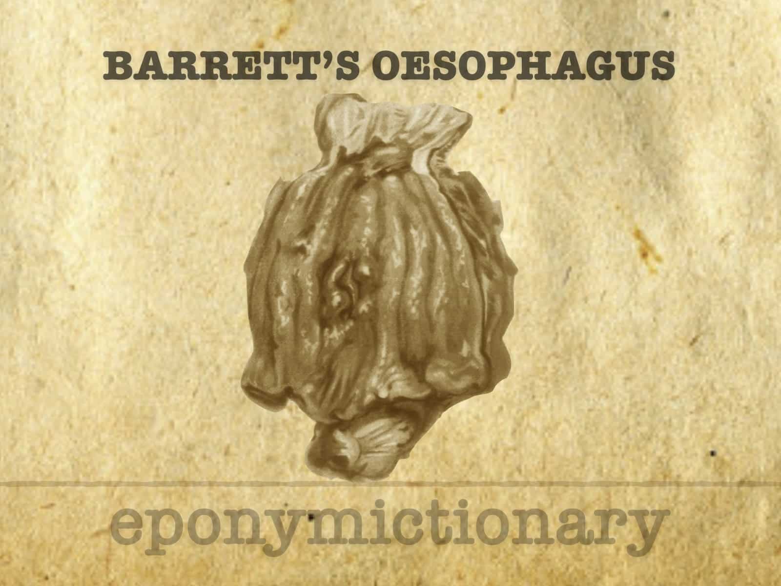 Philip Allison Archives • LITFL