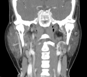CT Case 073 • LITFL • CT scan interpretation