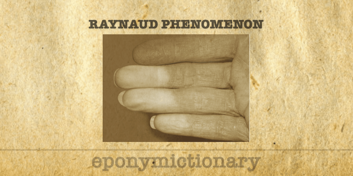 Raynaud phenomenon • LITFL • Medical Eponym Library
