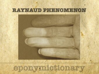 Raynaud phenomenon Archives • LITFL