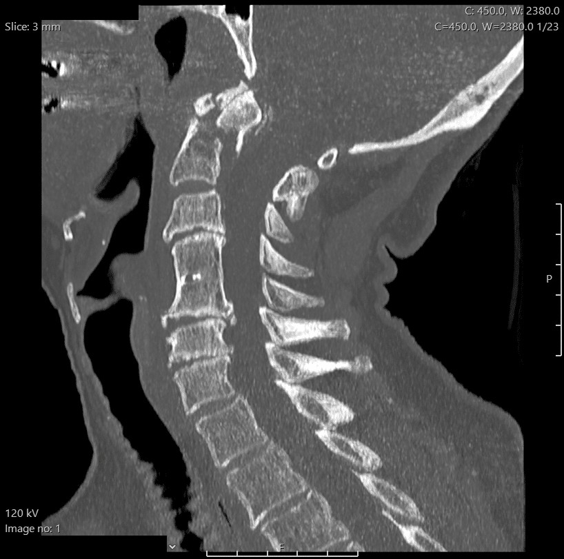 CT Case 063 • LITFL • CT scan interpretation