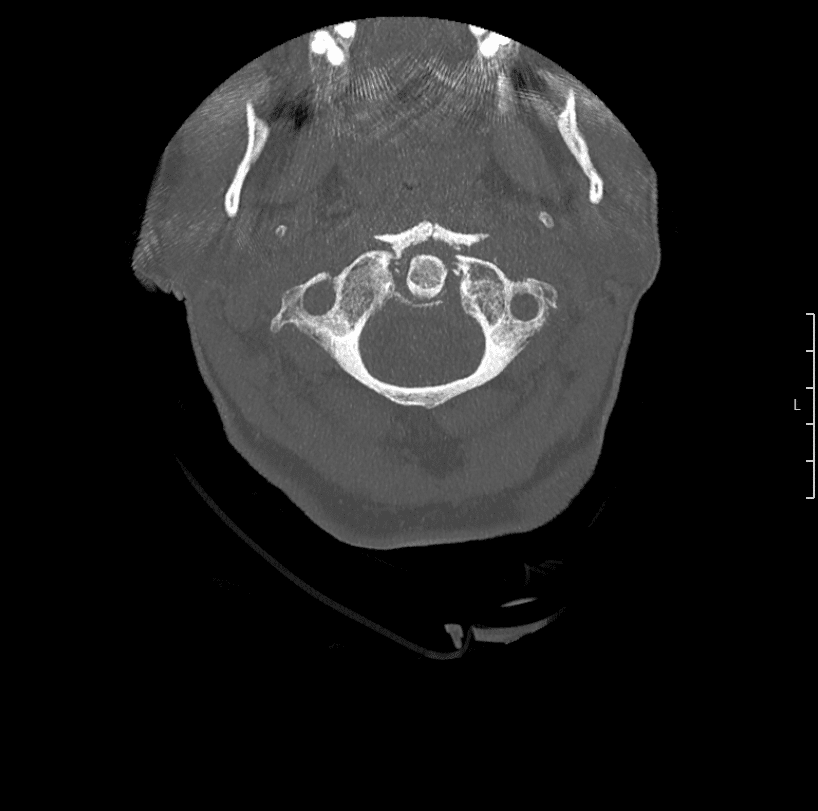 CT Case 063 • LITFL • CT scan interpretation