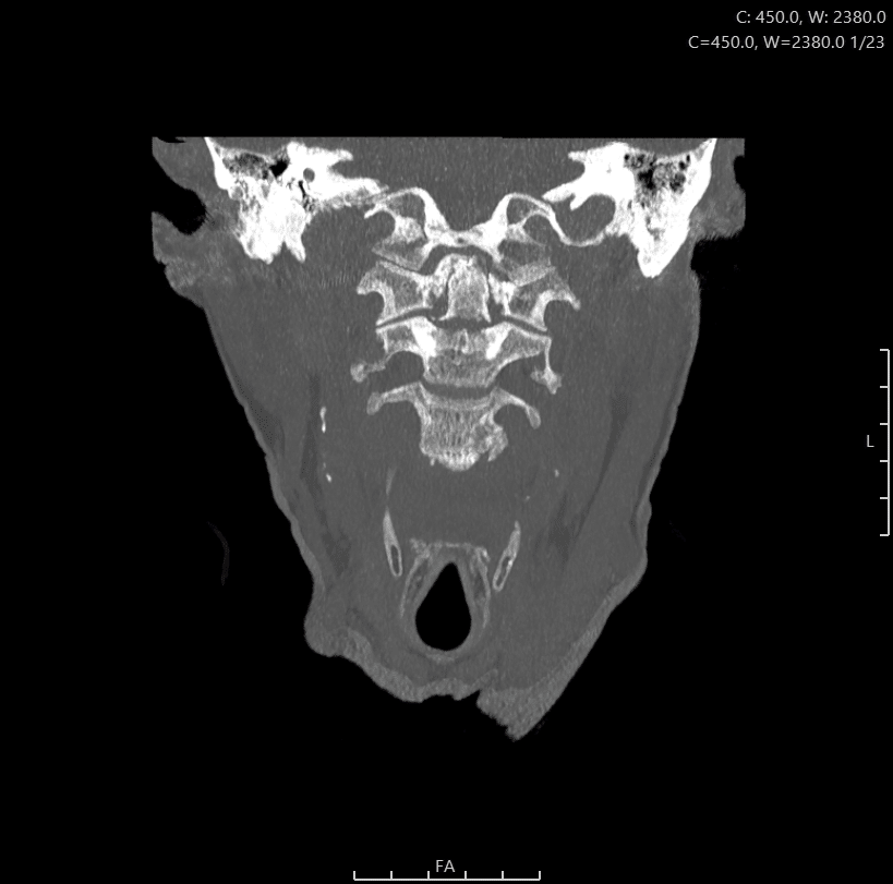 CT Case 063 • LITFL • CT scan interpretation