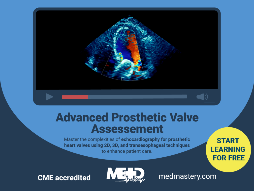 MI Localization • LITFL • ECG Anatomy Basics