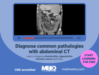 Subarachnoid Haemorrhage (SAH) • LITFL • CCC Neurosurgery