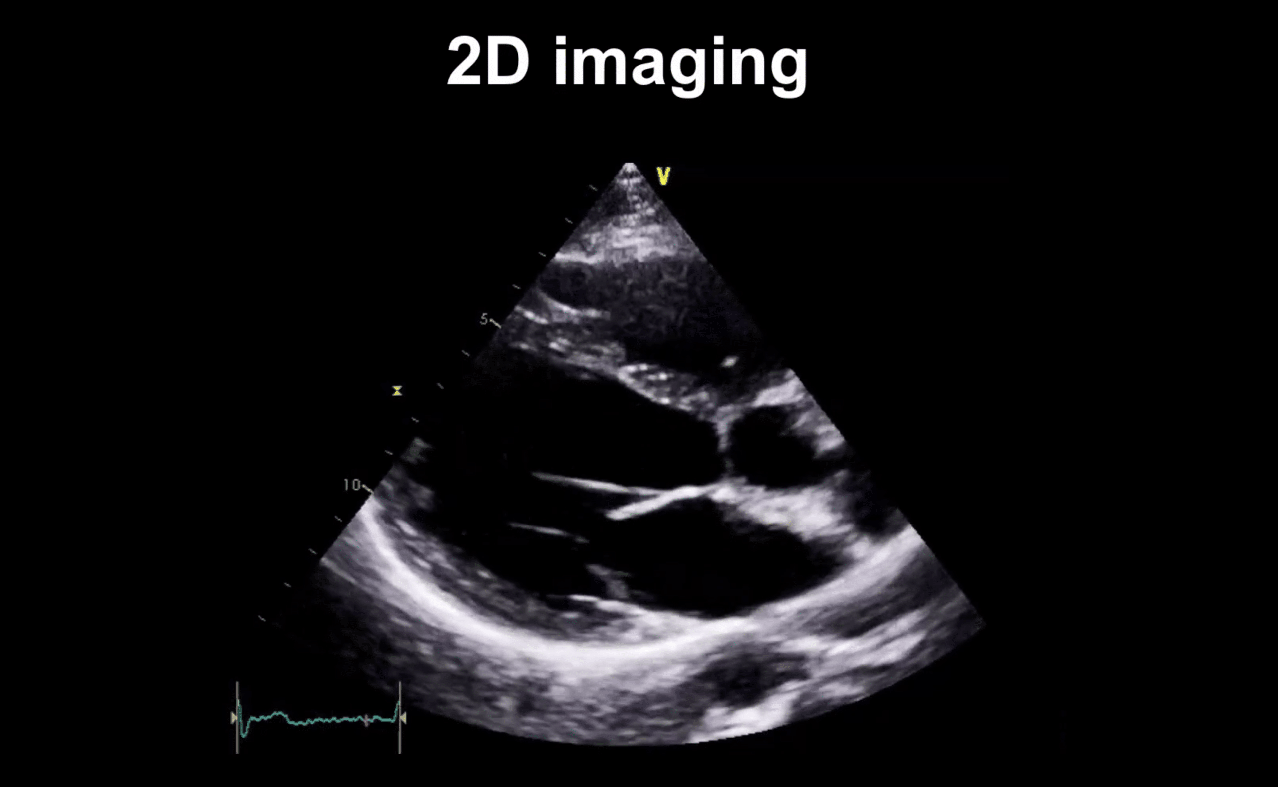 Echo basics: Key concepts • LITFL • Radiology Library
