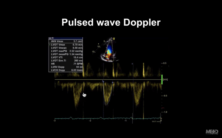 Echo basics: Key concepts • LITFL • Radiology Library