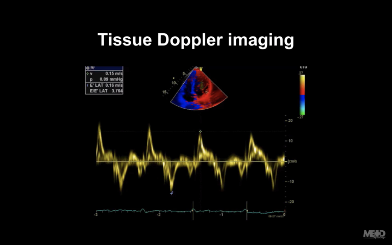 Echo basics: Key concepts • LITFL • Radiology Library