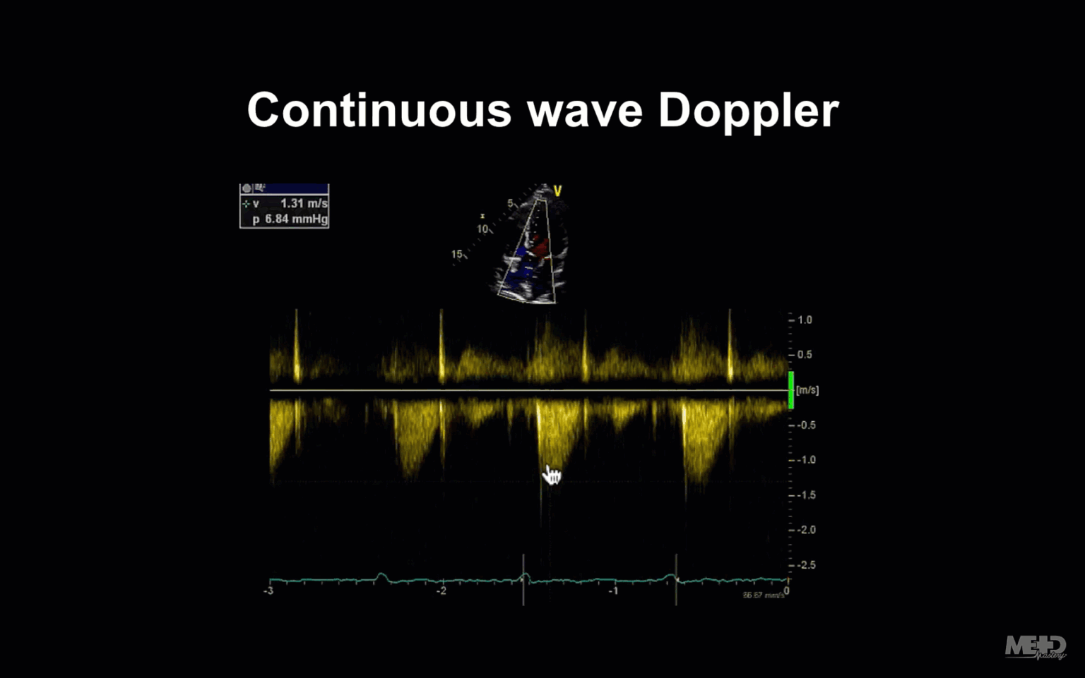 Echo basics: Key concepts • LITFL • Radiology Library