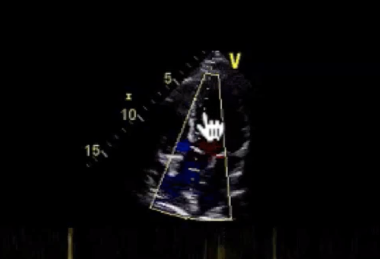 Echo basics: Key concepts • LITFL • Radiology Library