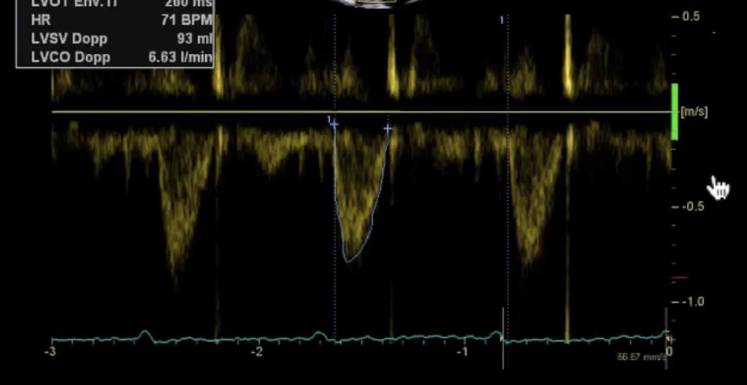 Echo basics: Key concepts • LITFL • Radiology Library