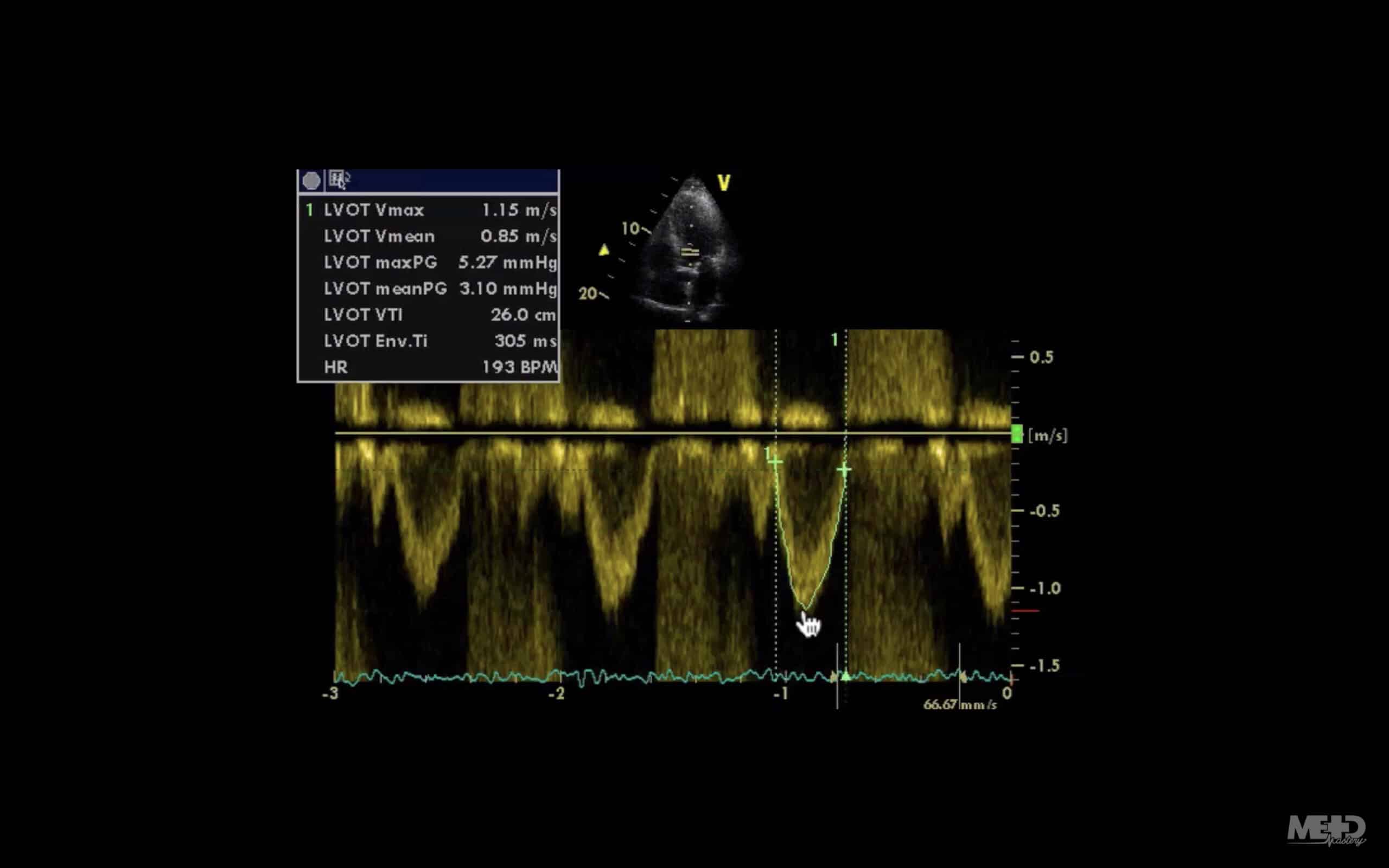 Echo basics: Key concepts • LITFL • Radiology Library