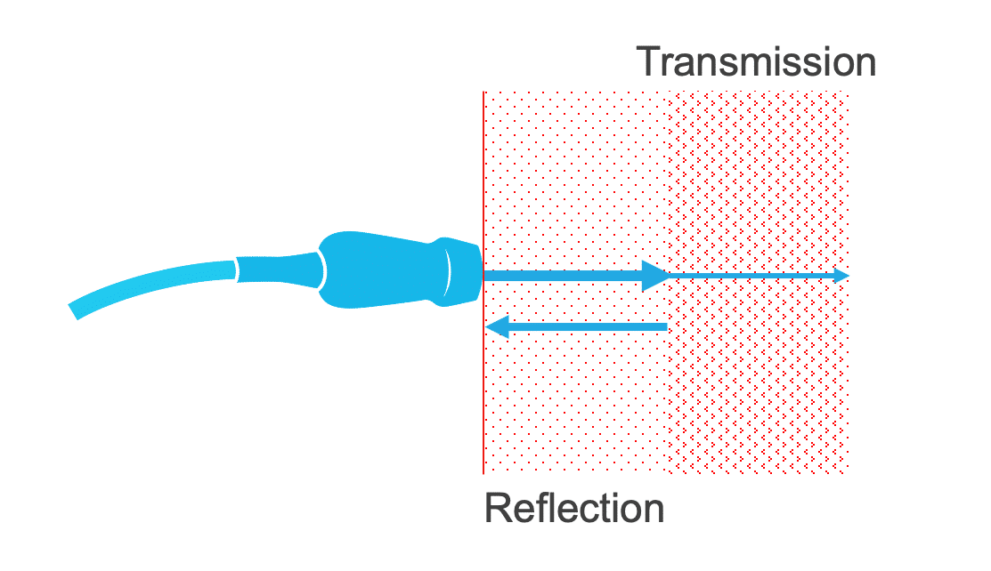 Echo basics: Key concepts • LITFL • Radiology Library