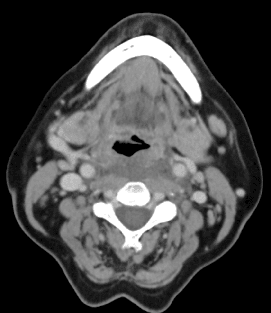 CT Case 076 • LITFL • CT scan interpretation