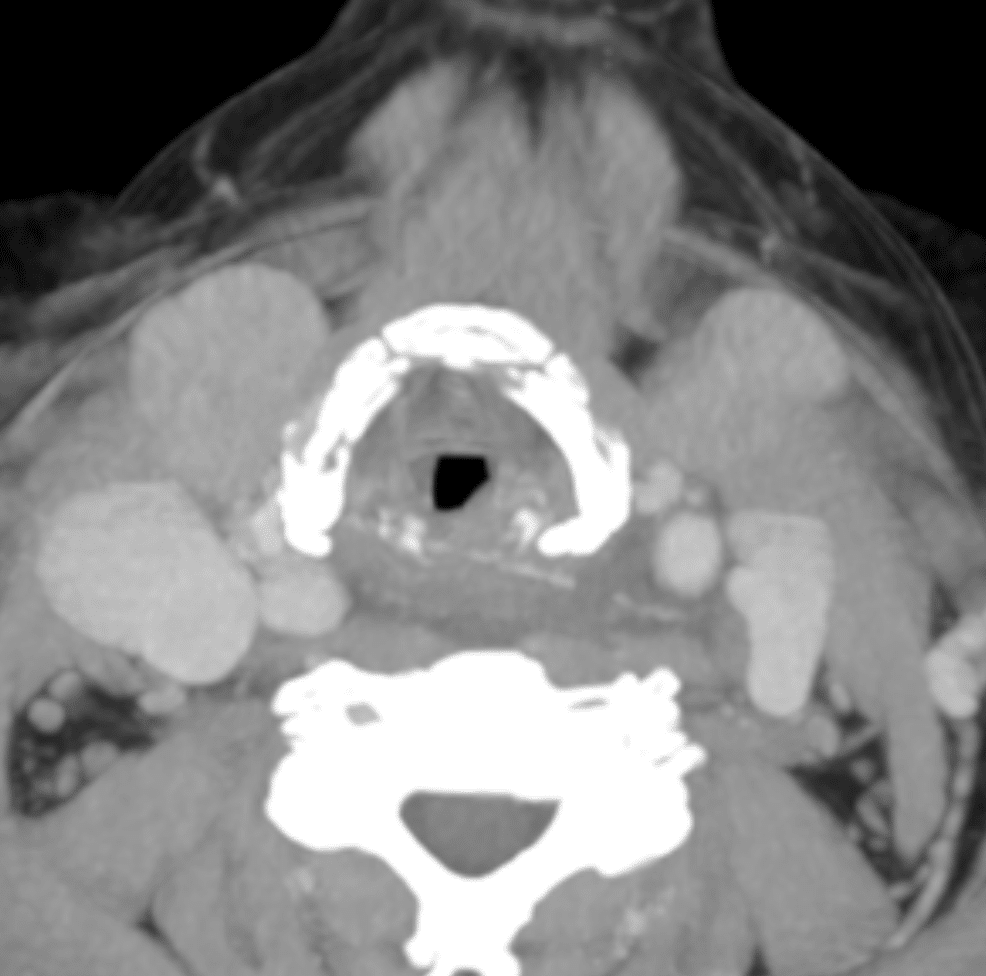 CT Case 076 • LITFL • CT scan interpretation