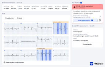 Activate or Wait - 008 • LITFL • Top 100 ECG