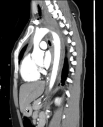 CT Case 085 • LITFL • CT scan interpretation