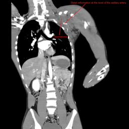 CT Case 086 • LITFL • CT scan interpretation