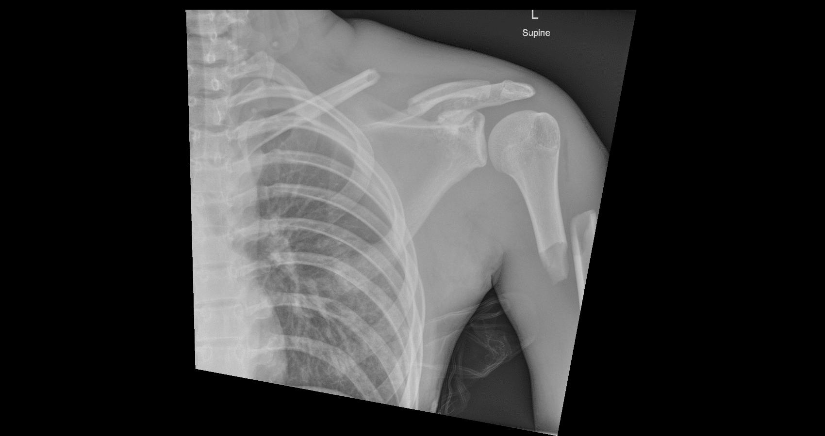 CT Case 086 • LITFL • CT scan interpretation