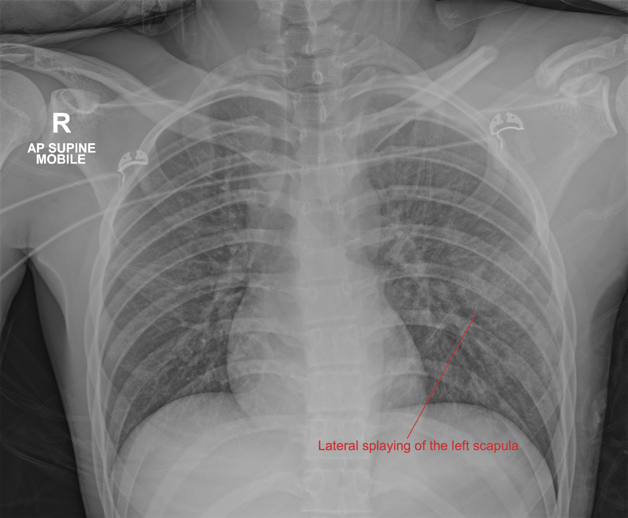 CT Case 086 • LITFL • CT scan interpretation