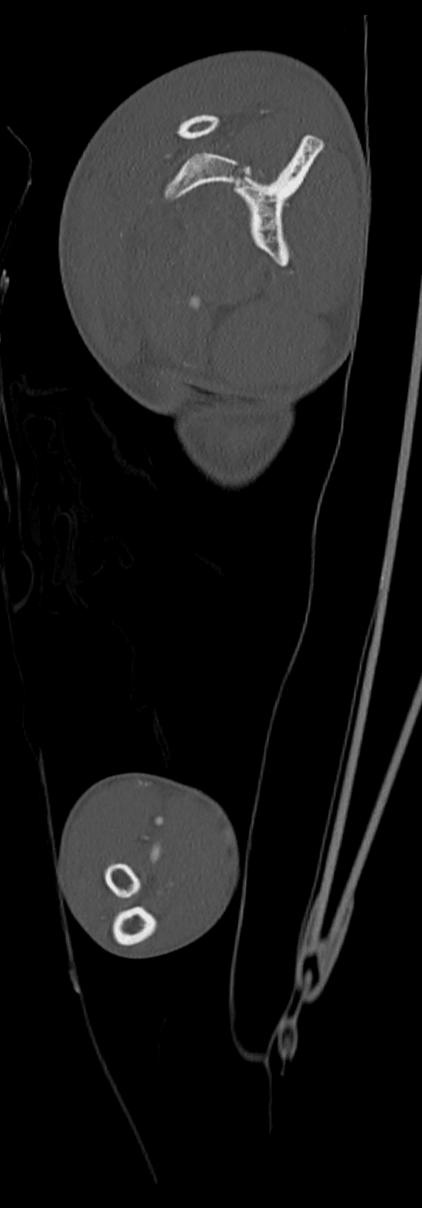 CT Case 086 • LITFL • CT scan interpretation